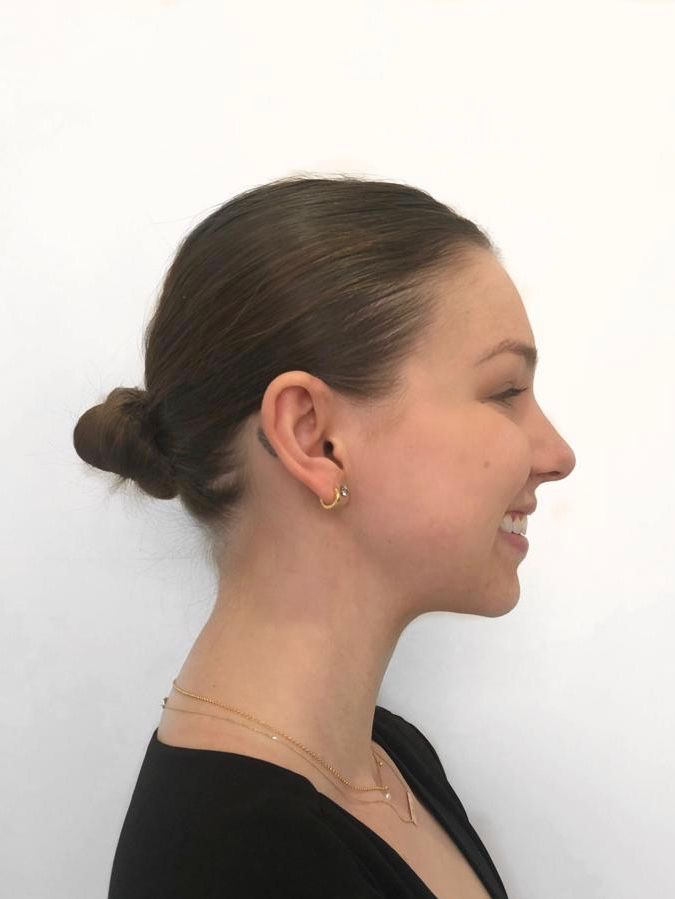 Teeth Assessment - No Gaps Dental